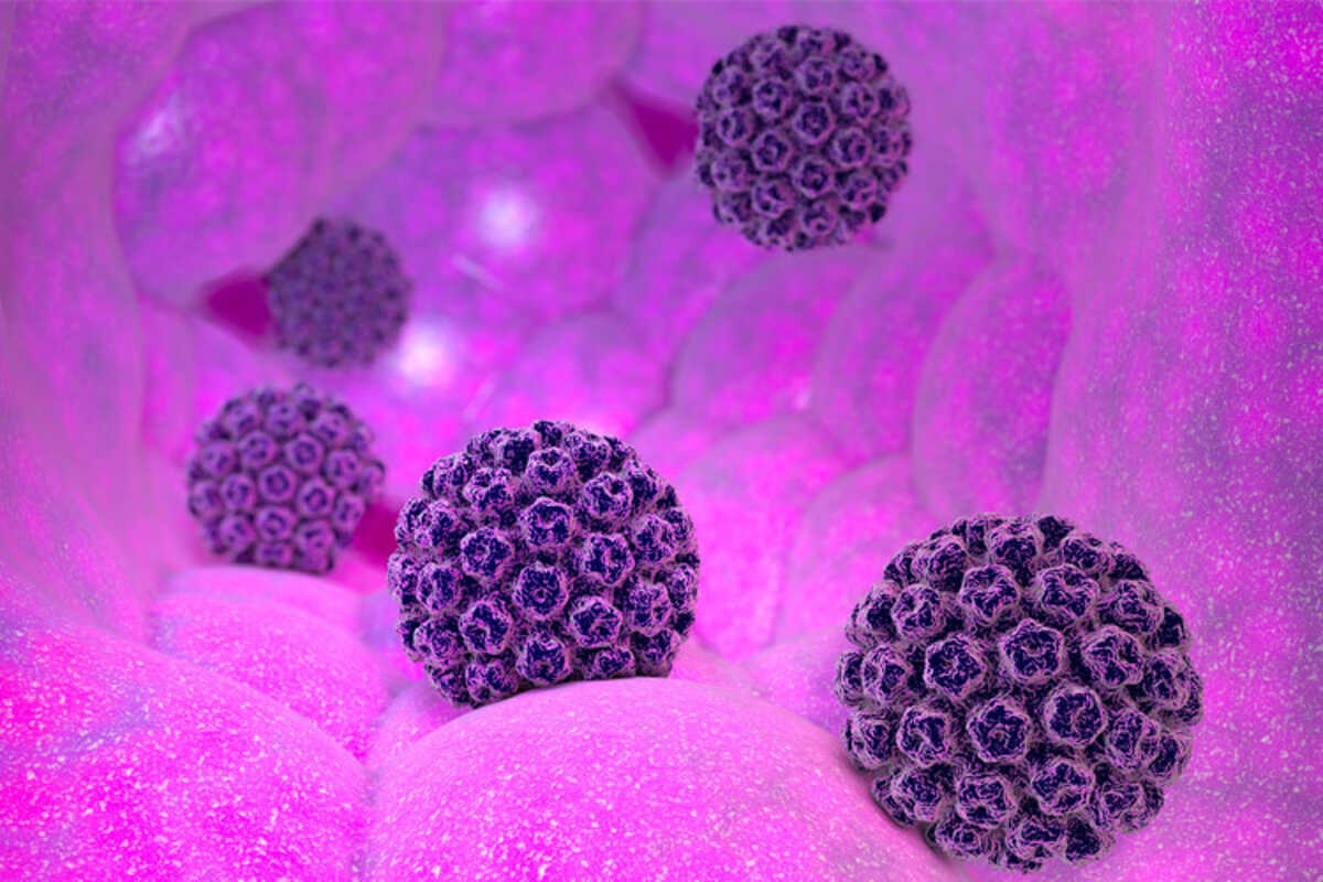 Julho Verde: HPV amplia risco de câncer de boca e garganta entre jovens ...