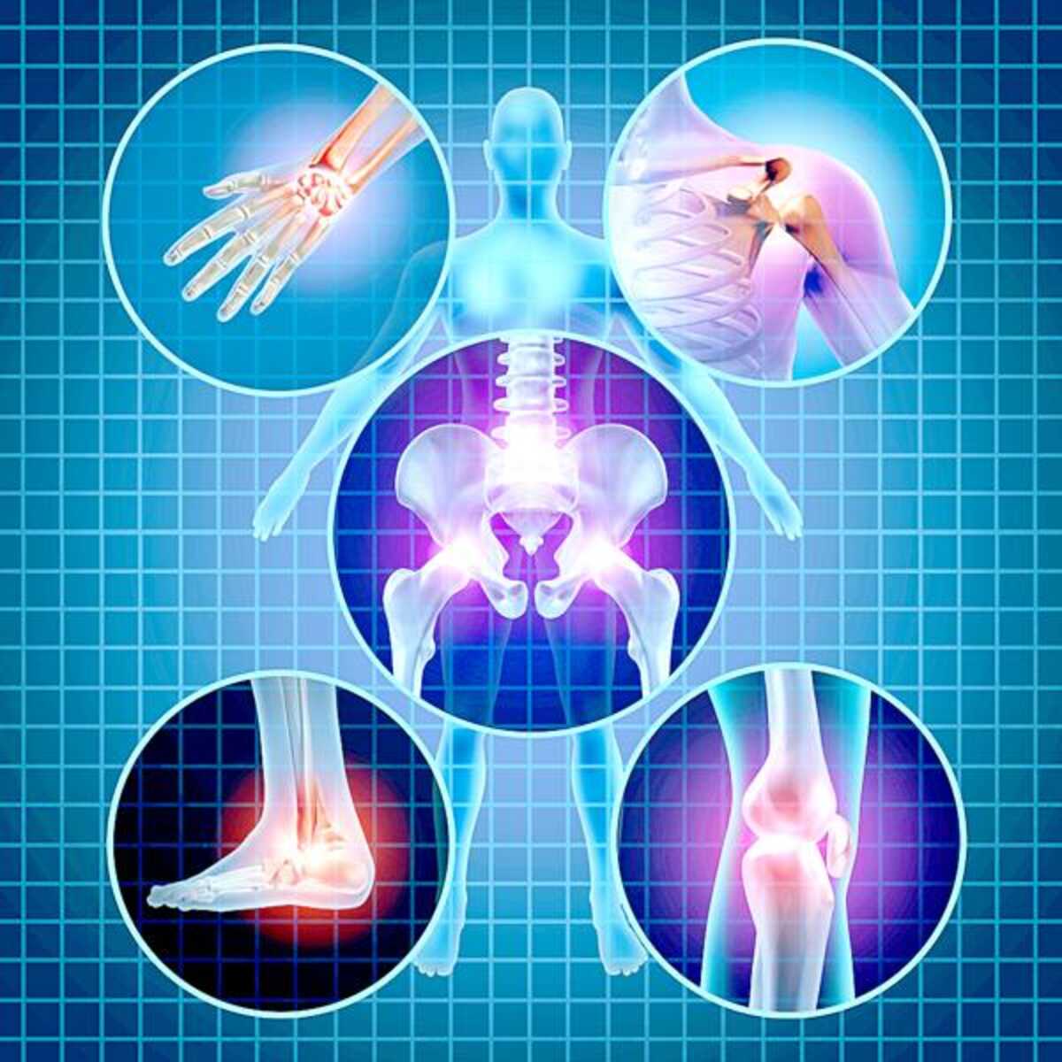 Osteoporose: o que é, causas, sintomas e tratamentos - Diário do Litoral